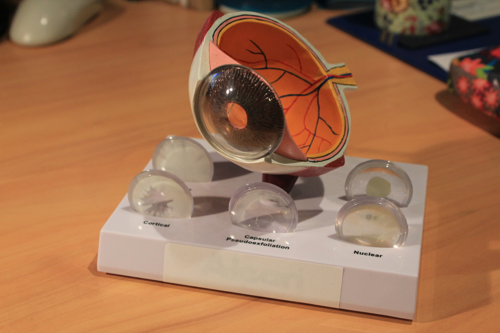 IMG_1826-model-of-eye-showing-cataract-page-3-content-on-cataract ...
